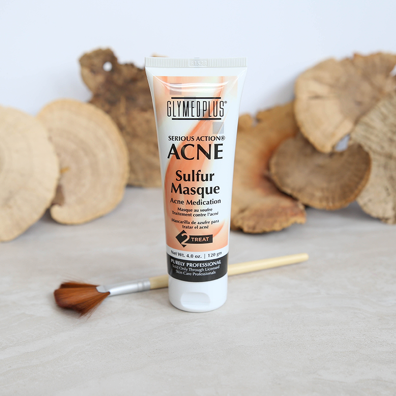 Sulfur Masque | BotanicalBeautyBar
